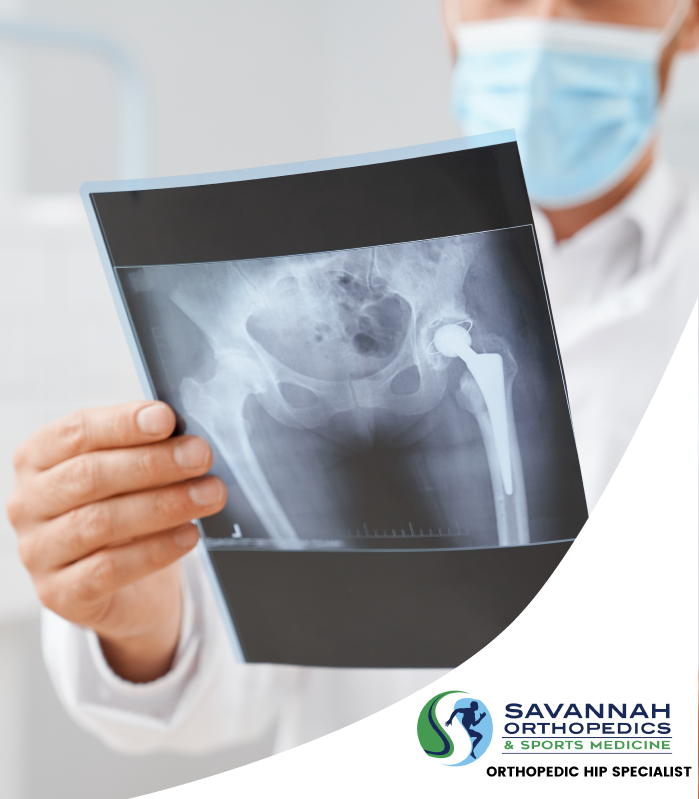 Hip Specialist in Savannah Ga - Savannah Orthopedics